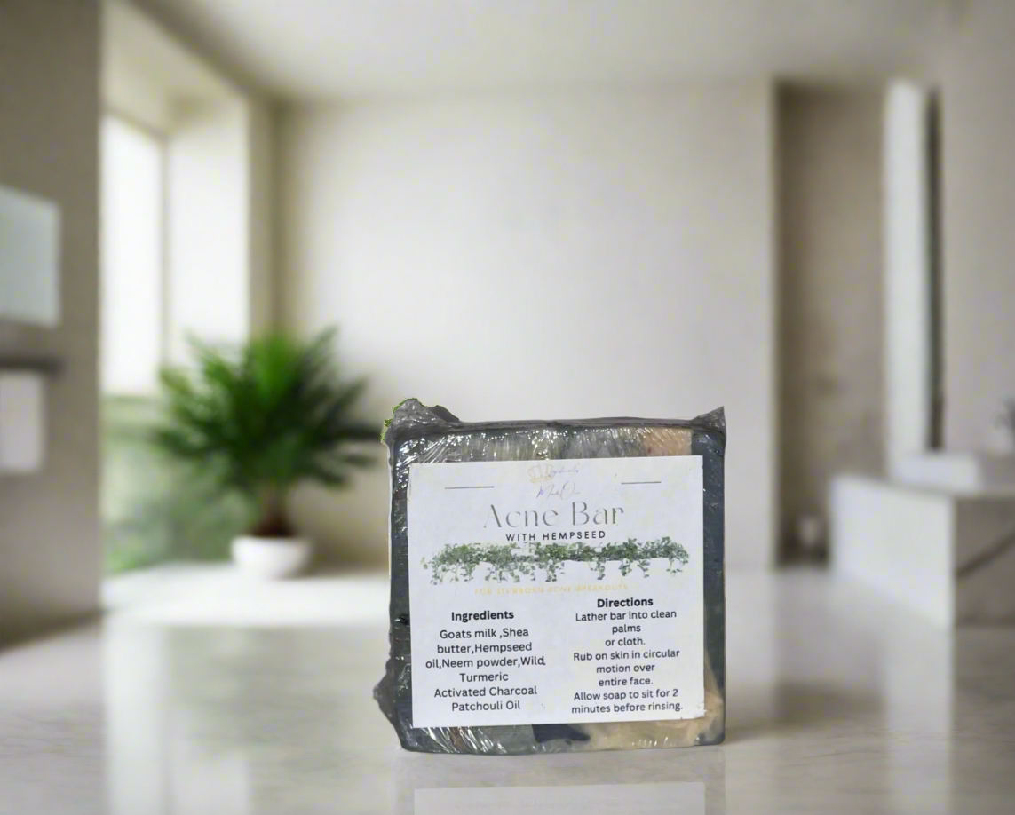 Acne Bar – Majestically Madeover