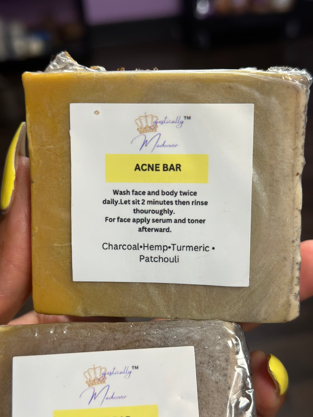 Acne Bar – Majestically Madeover